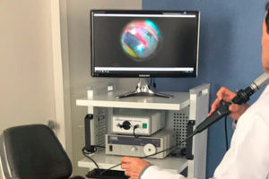 Vídeo nasofibrolaringoscopia – Clínica de Otorrino e Otoneuro